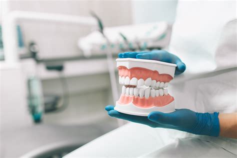 Treatment Of Wedge Shaped Defect Denta Vita [blog 2020]