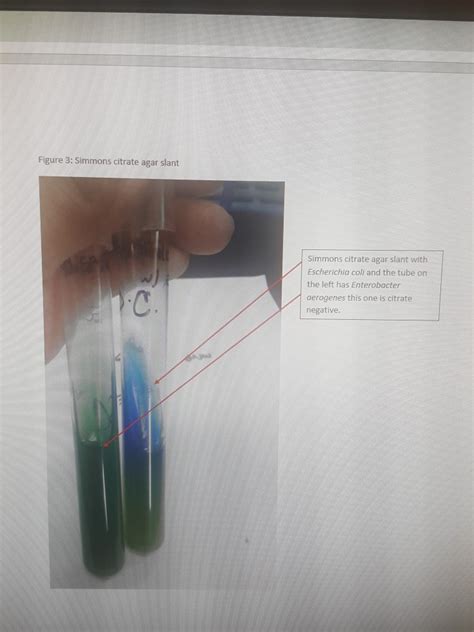 Solved Lab 14 Fermentation PURPOSE This Lab Was To Chegg