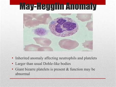 Wbc And Platelets Anomalies Pptx Blood Disorders Diseases And