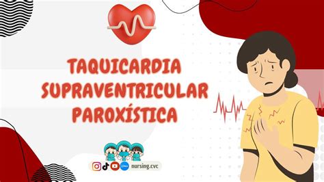Taquicardia Supraventricular Paroxística Nursingcvc Udocz