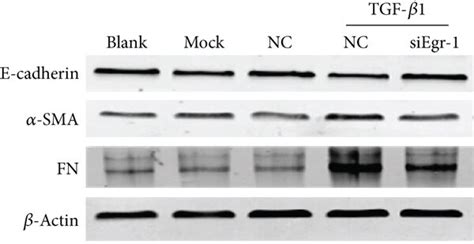TGF β1 induced EMT reversed by siEgr 1 in NRK 52E cells NRK 52E cells