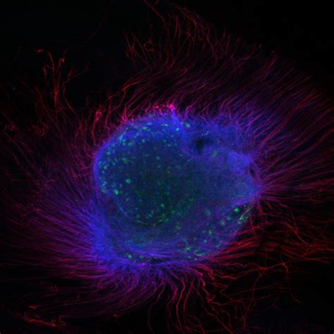 Beauty Of Microscopy Beautyofmicroscopy Tumblr Blog Tumlook