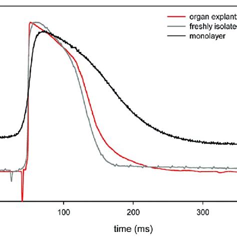 A Action Potential Duration At 20 50 70 And 90 Repolarization