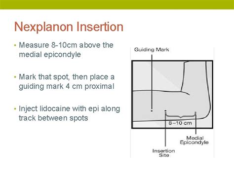 Long Acting Reversible Contraceptives The Basics Objectives Explain