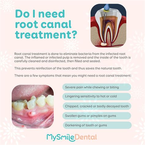Root Canal Gum Infection