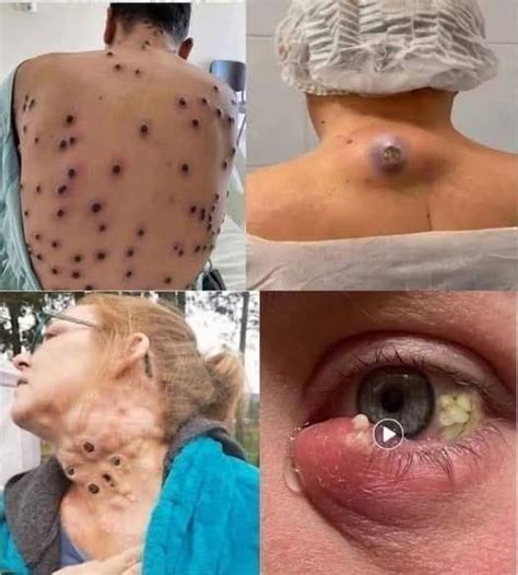 Jaylin These Are The Signs That Its Gro Details In The First