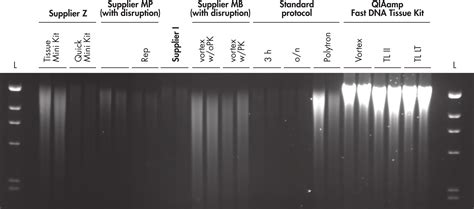 Qiaamp Fast Dna Tissue Kit