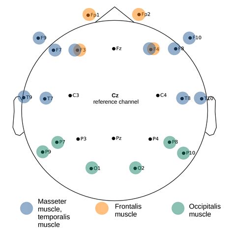Encoder With The Empirical Mode Decomposition Emd To Remove Muscle Artefacts From Eeg Signal