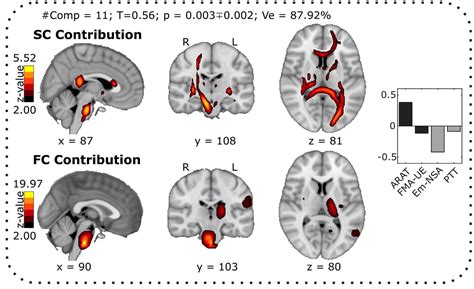 Multimodal And Multidomain Lesion Network Mapping Enhances Prediction Of Sensorimotor Behavior