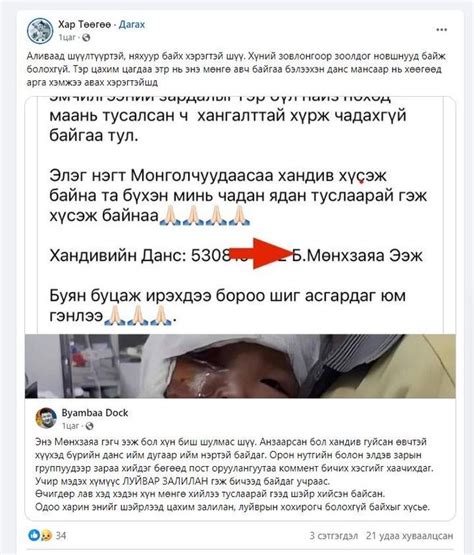 ЦЕГ Өвчтэй хүүхдийн зураг ашиглан 10 дансаар залилах гэмт хэрэг үйлдсэн байж болзошгүй