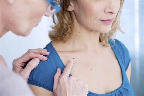 Mohs Surgery Recovery And Aftercare Your Post Op Guide