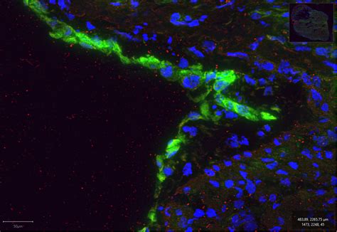 Why Would Nuclear Targets Appear Outside Nucleus On Immunofluorescence