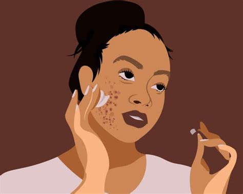 How To Use Pimple Patches And What To Avoid From Expert Ipsy