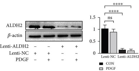 Aldh2 Deficiency Exacerbates Pulmonary Vascular Remodeling And
