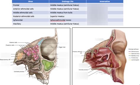 Middle Meatus Drainage