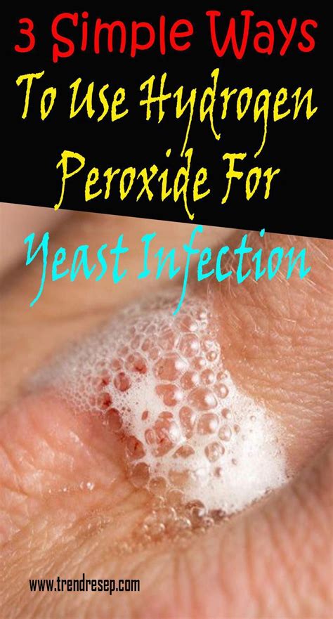 Yeast Infection Cure Yeast Infection In Men Yeast