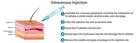 Intramuscular Injection Explanation Illustration Stock Vector By