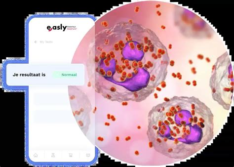 Gonorrhea Home Test From The Comfort Of Your Own Dwelling