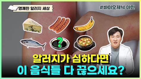 알레르기 검사에 나온 음식 피해도 알러지 반응이 알레르기 심할 땐 이 식품들을 피해보세요 Youtube