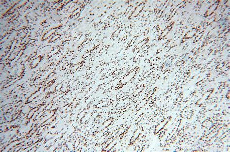 Psme3 Antibody 14907 1 Ap Proteintech