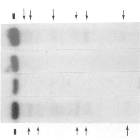 Analysis Of Immunoglobulin Heavy Chain Gene Rearrangements Was Download Scientific Diagram
