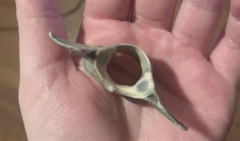 Mystery Pelvic Bone Rbonecollecting