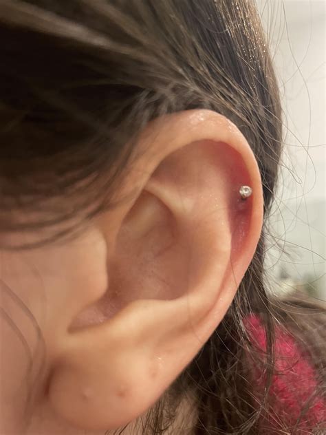 Piercing Bump Update Finally Healing R Piercing