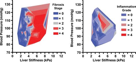 Hepatic Mr Elastography Clinical Performance In A Series Of 1377