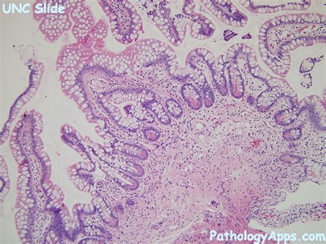 Ileum Small Intestine Histology