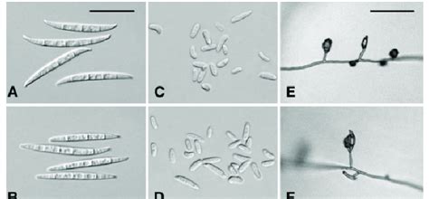 Microconidia Of Fusarium Fusarium Oxysporum
