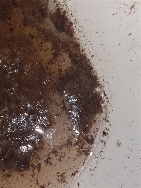 Is This Blood In My Vomit Rmedicaladvice