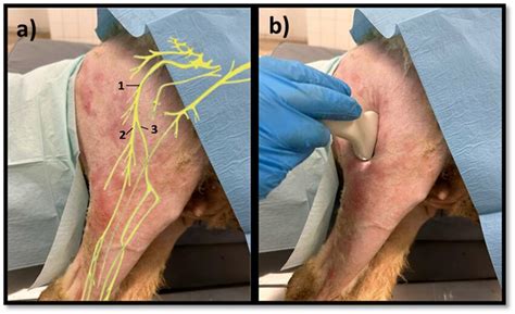 Sciatic Nerve Distribution
