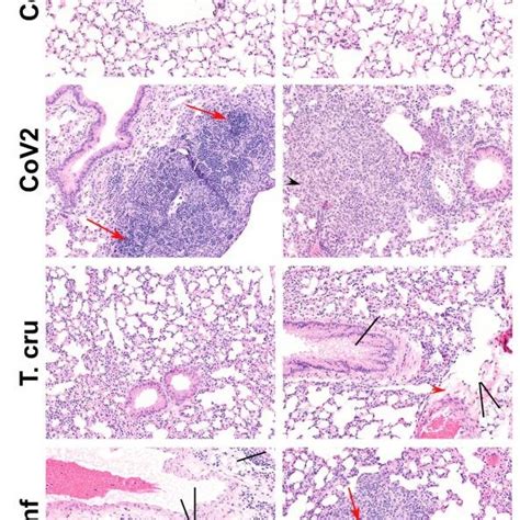 Histological Analysis Of The Lungs Download Scientific Diagram