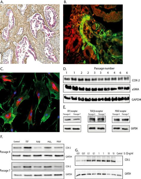 Cox 2 Expression In Formalin Fixed Paraffin Embedded Tumour Tissue Download Scientific Diagram