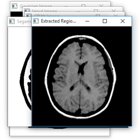 Brain Tumor Segmentation With Opencv Python Ph