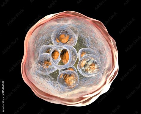 Hydatid Cyst Of Echinococcus Granulosus Stock Illustration Adobe Stock