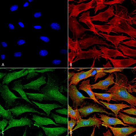 Mc1 Antibodies