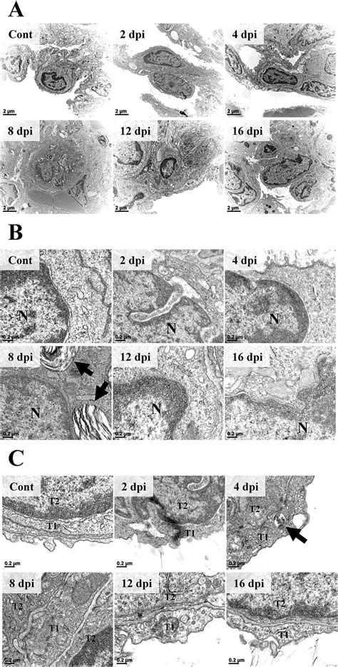 Ultrastructural Features Of The Alveolar Epithelium Following Infection