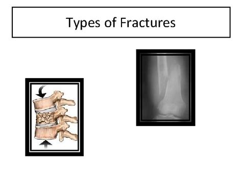 Musculoskeletal System Hit 241 Advanced Cpt Coding Chapter