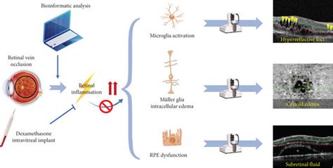 Schematic Diagram Depicts The Involvement Of Retinal Inflammation In