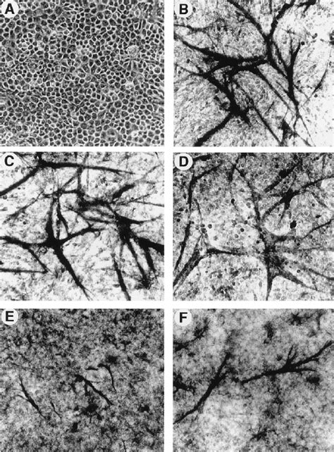 Development Of Tube Like Structures In Human Microvascular Endothelial