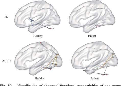 figure 10 from knowledge distillation guided interpretable brain
