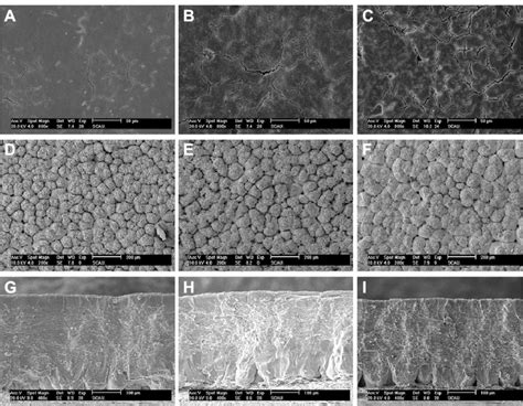 Microstructure Of Duck Eggshell During Calcium Depletion Period