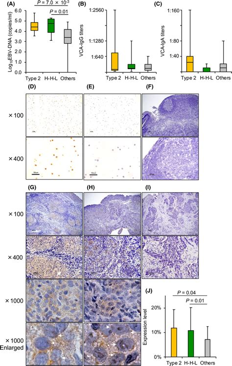 Comparison Of Clinical Features Of Japanese Npc Categorized Using Ebv