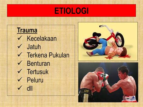 Cidera Kepala Pptx