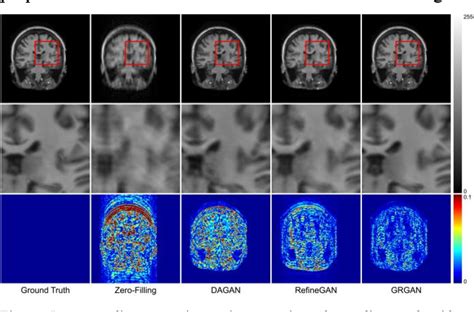 Figure 4 From Mri Reconstruction Using Graph Reasoning Generative