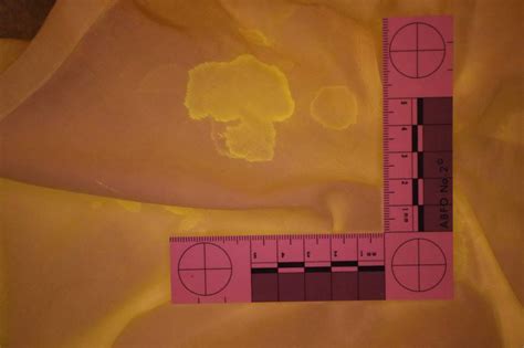 The Best Technology For Forensic Medical Examinations