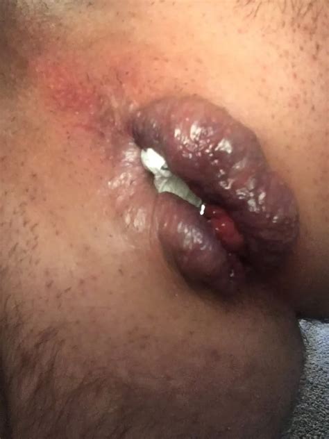 Tunnel Plug 29 Pics Xhamster