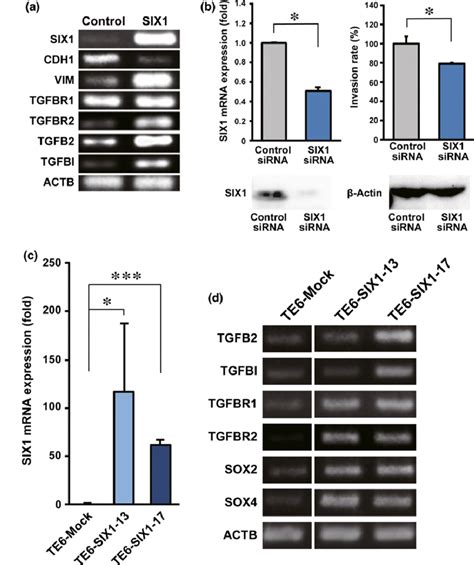 SIX1 Regulated Genes Related To Epithelialmesenchymal Transition EMT
