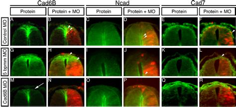 Neural Crest Cell Delamination Semantic Scholar